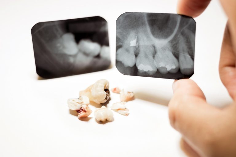 Understanding Chewing Difficulties: 4 Common Causes | Nutty Goodness